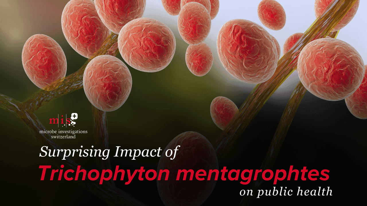 Trichophyton Mentagrophytes Public Health Impact & solutions