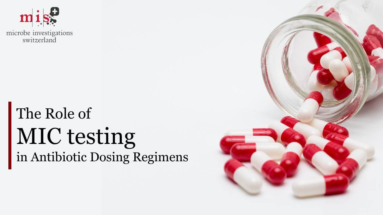 MIC Testing in Antibiotic Dosing Regimens