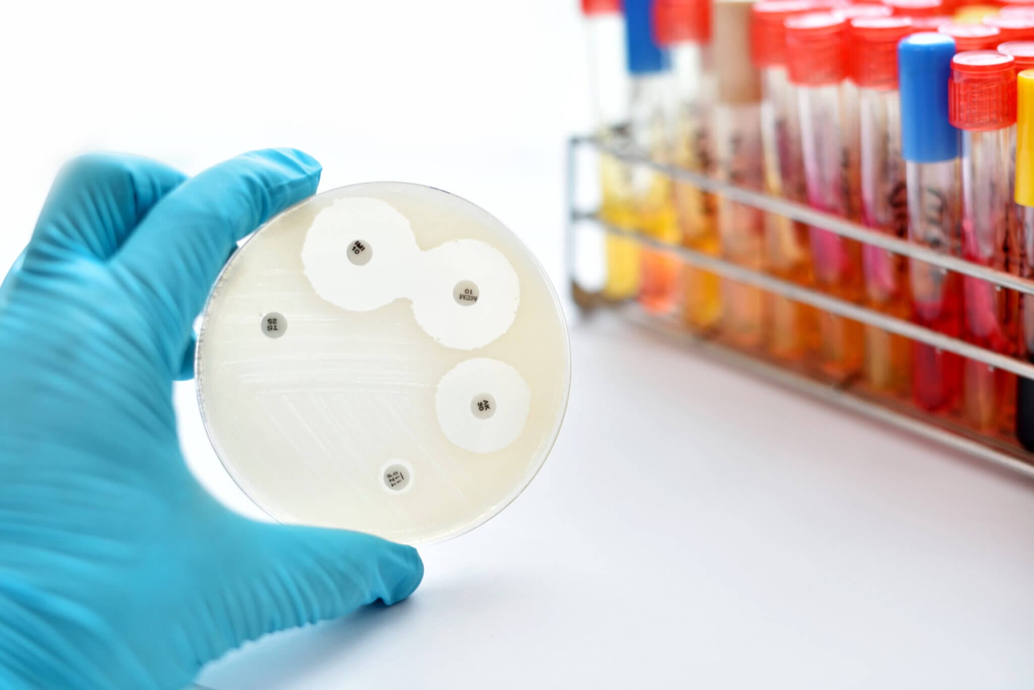 MIC Testing: Tailoring Antibiotic Potency Through Precise Testing