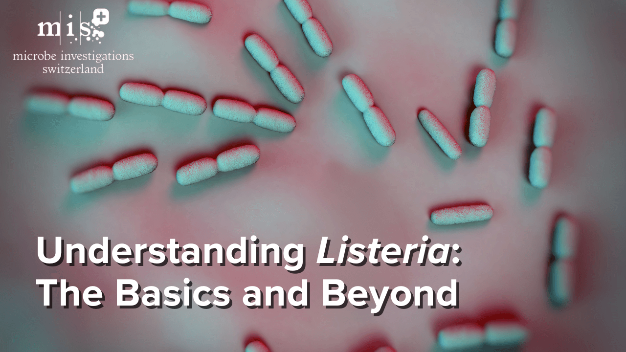 Understanding Listeria Management: Basics and Beyond