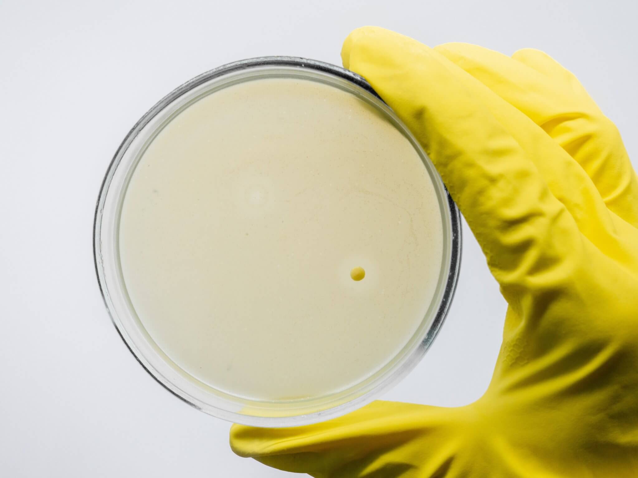 Why 4 Log Reduction is Mandatory for EN 14476?