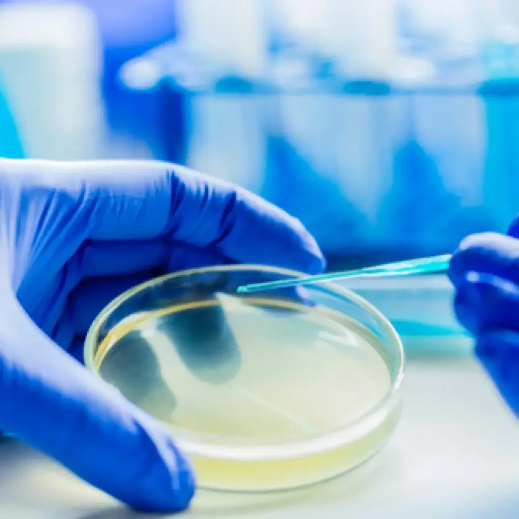 Antibacterial Testing Laboratory - Microbe Investigations