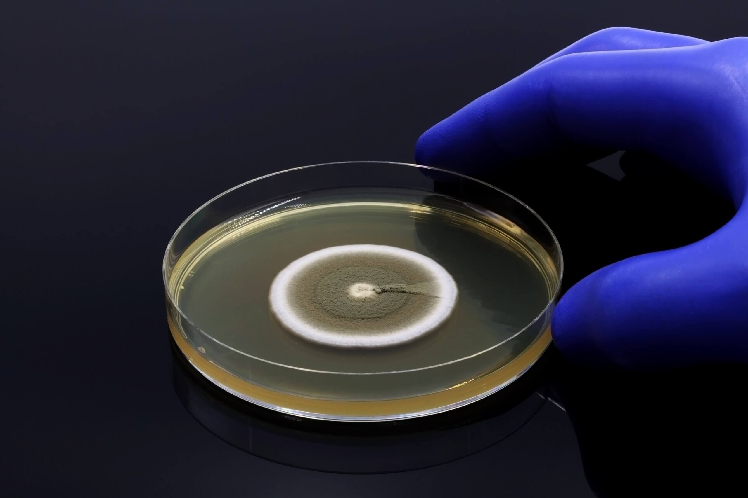 Fungal Resistance Testing