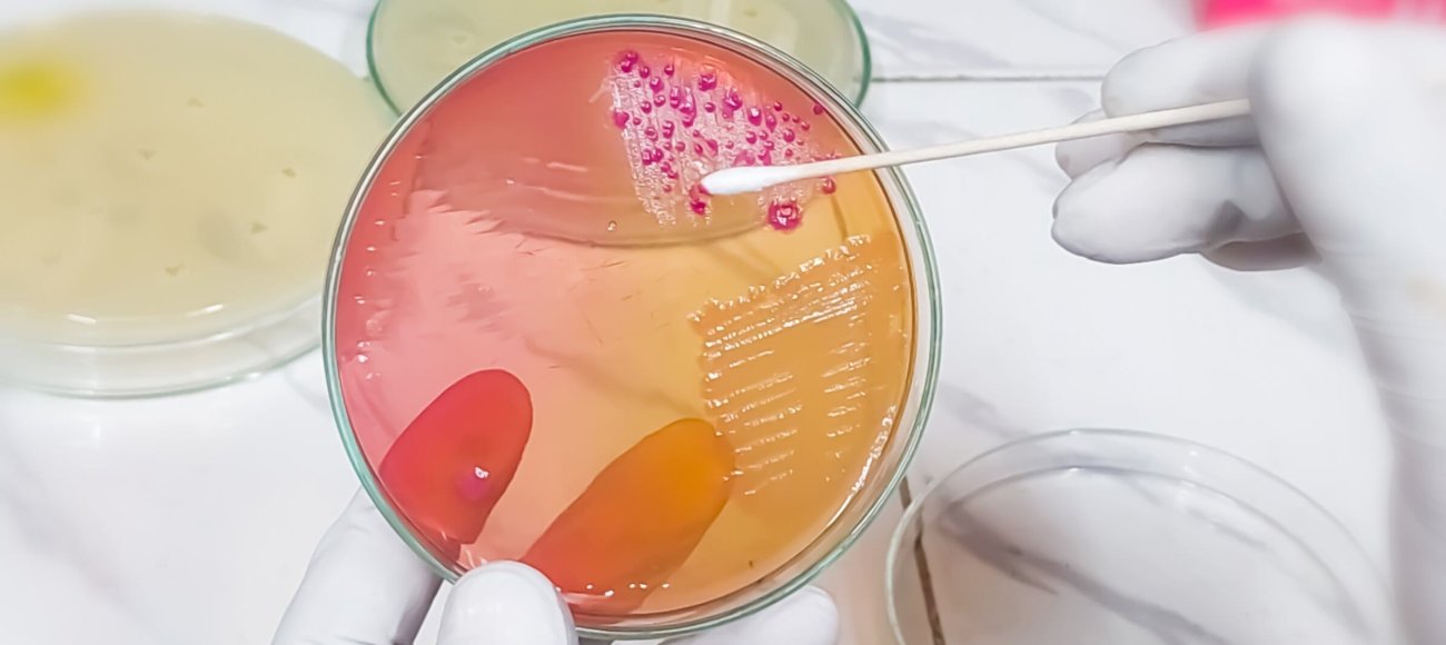 Understanding the Importance of Antimicrobial Effectiveness Testing in ...