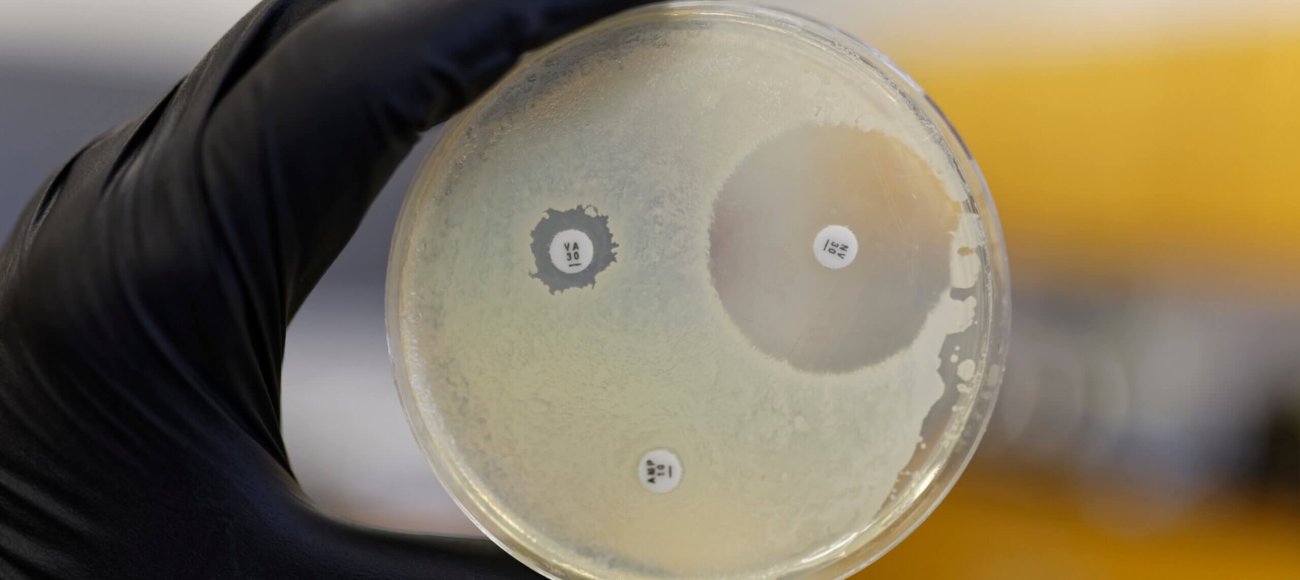 ZOI Testing : The Importance of Environmental Factors