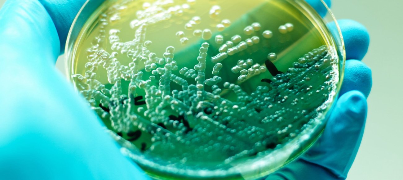 Bacterial Endotoxin Testing Services